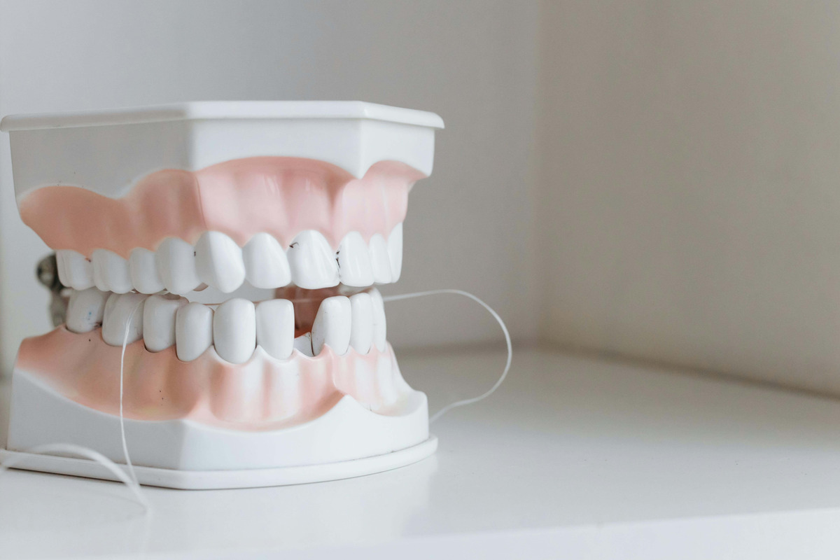 Overdentures 101 | Modern Tooth Replacement Options Explained